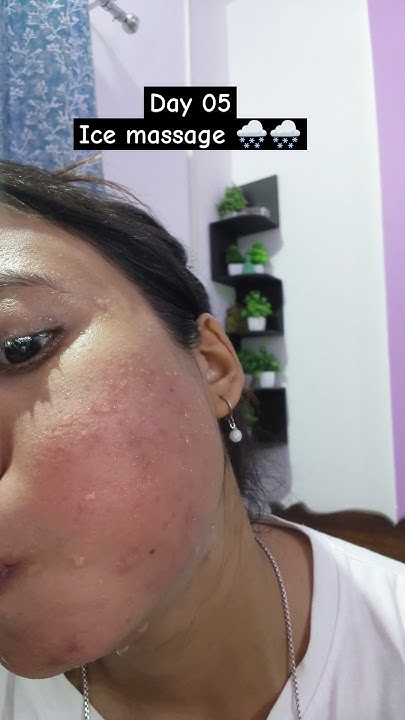 30 days ice massage challenge #day05 - YouTube