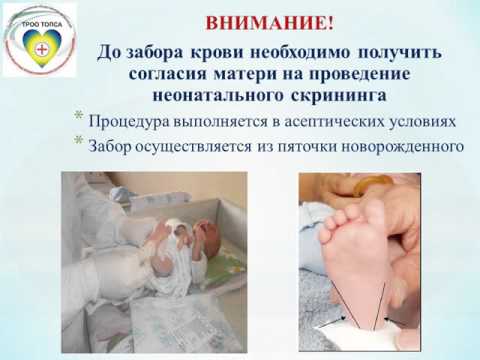 Неонатальный скрининг новорожденных - YouTube