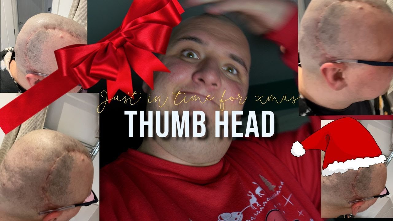 Killing Chonk Ep13 - THUMB HEAD mode enabled - YouTube