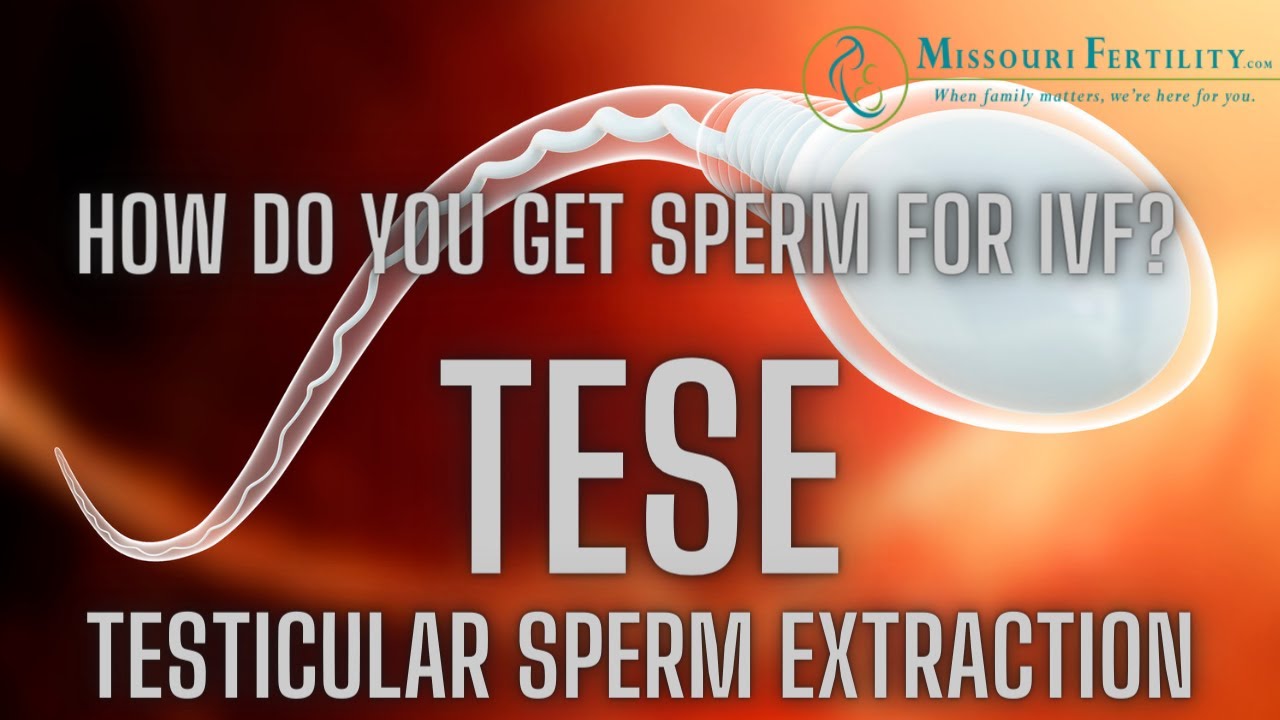 TESE: Getting Sperm for IVF - YouTube