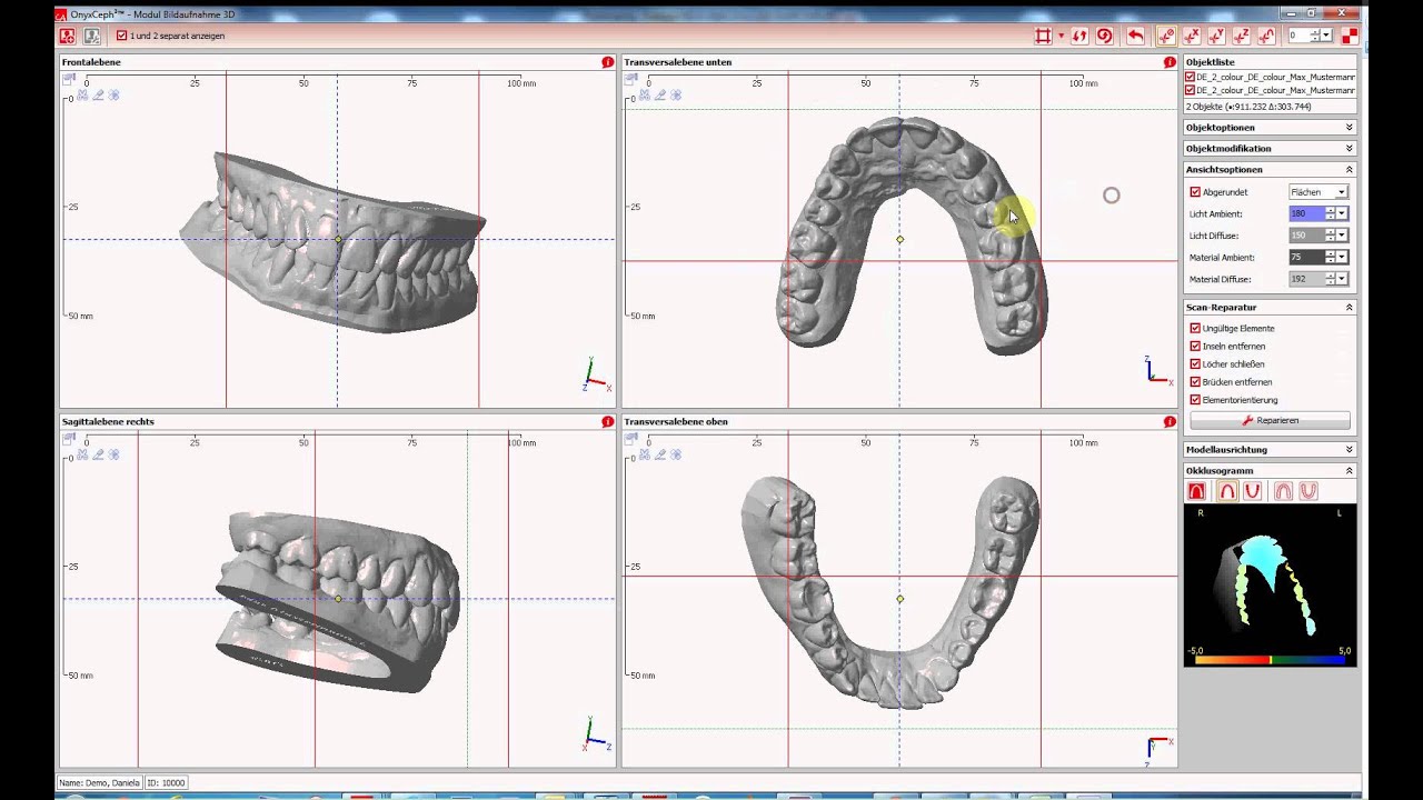 stl file import - CA Smart 3D - YouTube