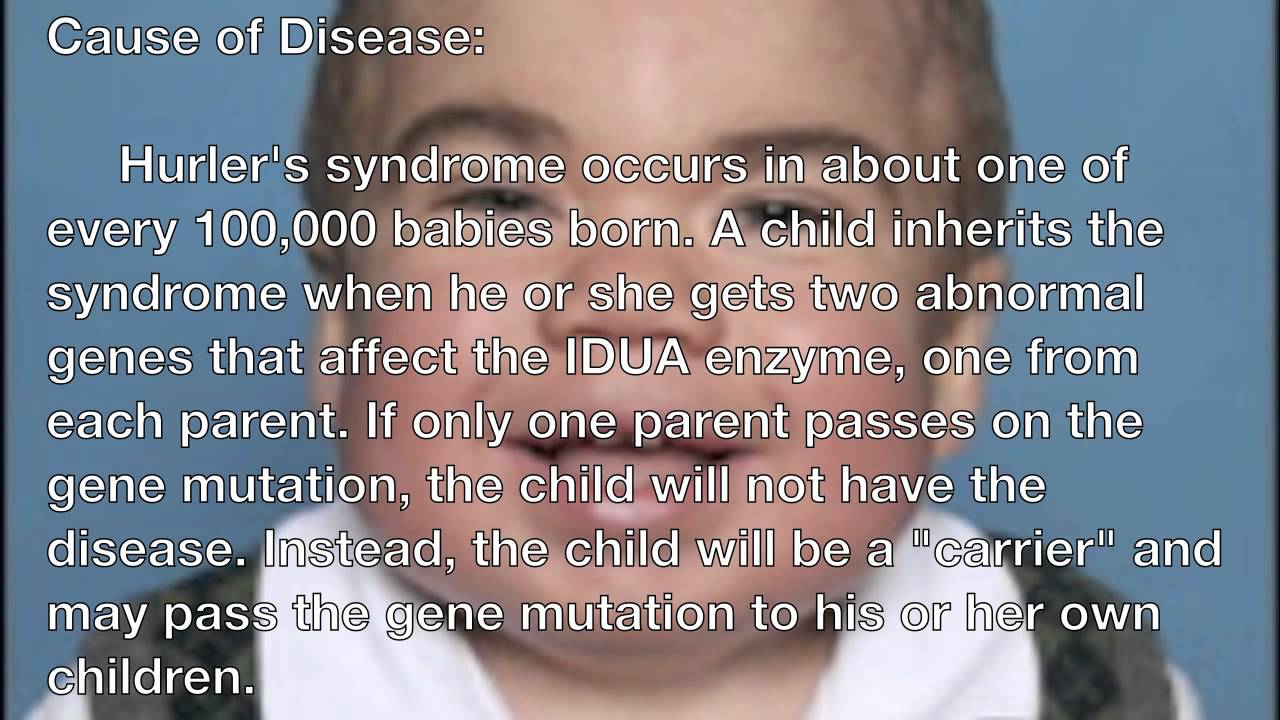 Gargoylism In Children Stevens Lecture: Low... Stevens Scientific