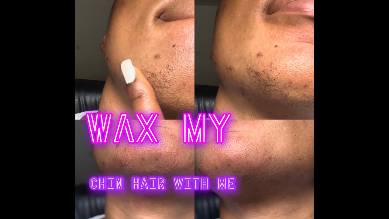 HOW TO WAX YOUR CHIN HAIR WITH SUGAR WAX - YouTube