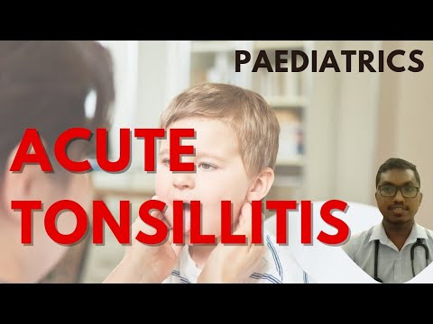 Acute Tonsillitis and Quincy | Paediatrics | Pathophysiology, Clinical ...