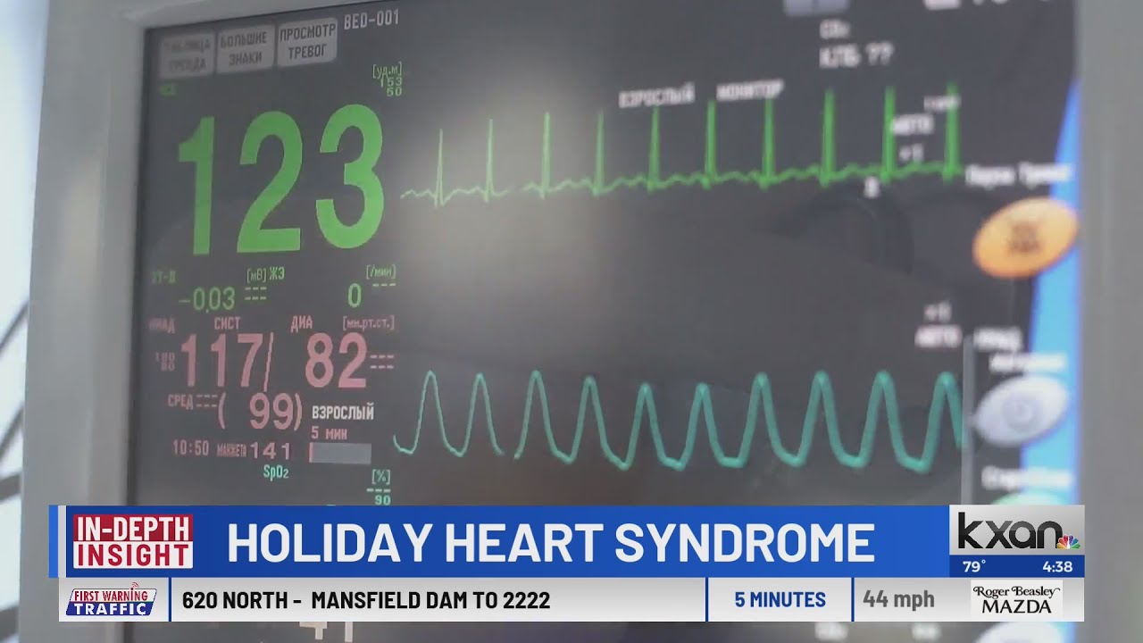 What is holiday heart syndrome, how it impacts your health - YouTube