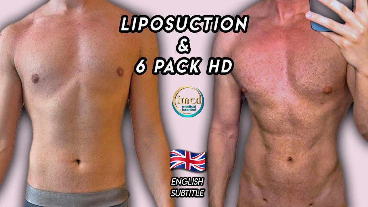 iMed Medical Videos - iMed Medical