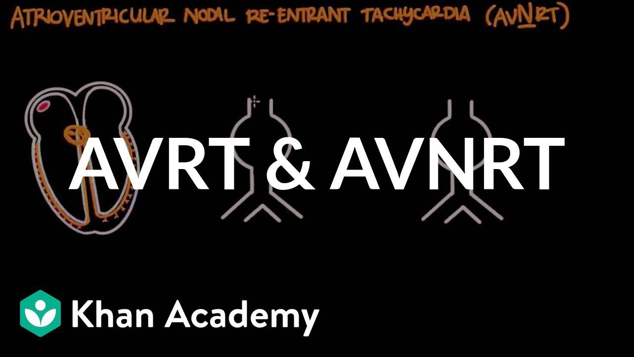 Atrioventricular reentrant tachycardia (AVRT) & AV nodal reentrant ...