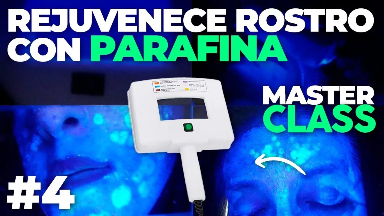 Comos Usar la Luz de WOOD para Detectar Melasmas |Clase 4| De 0 a ...
