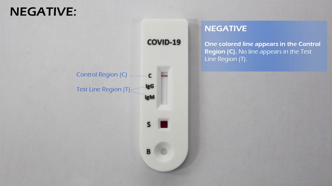 PARTNERS COVID 19: How to use a Rapid Test Kit - YouTube