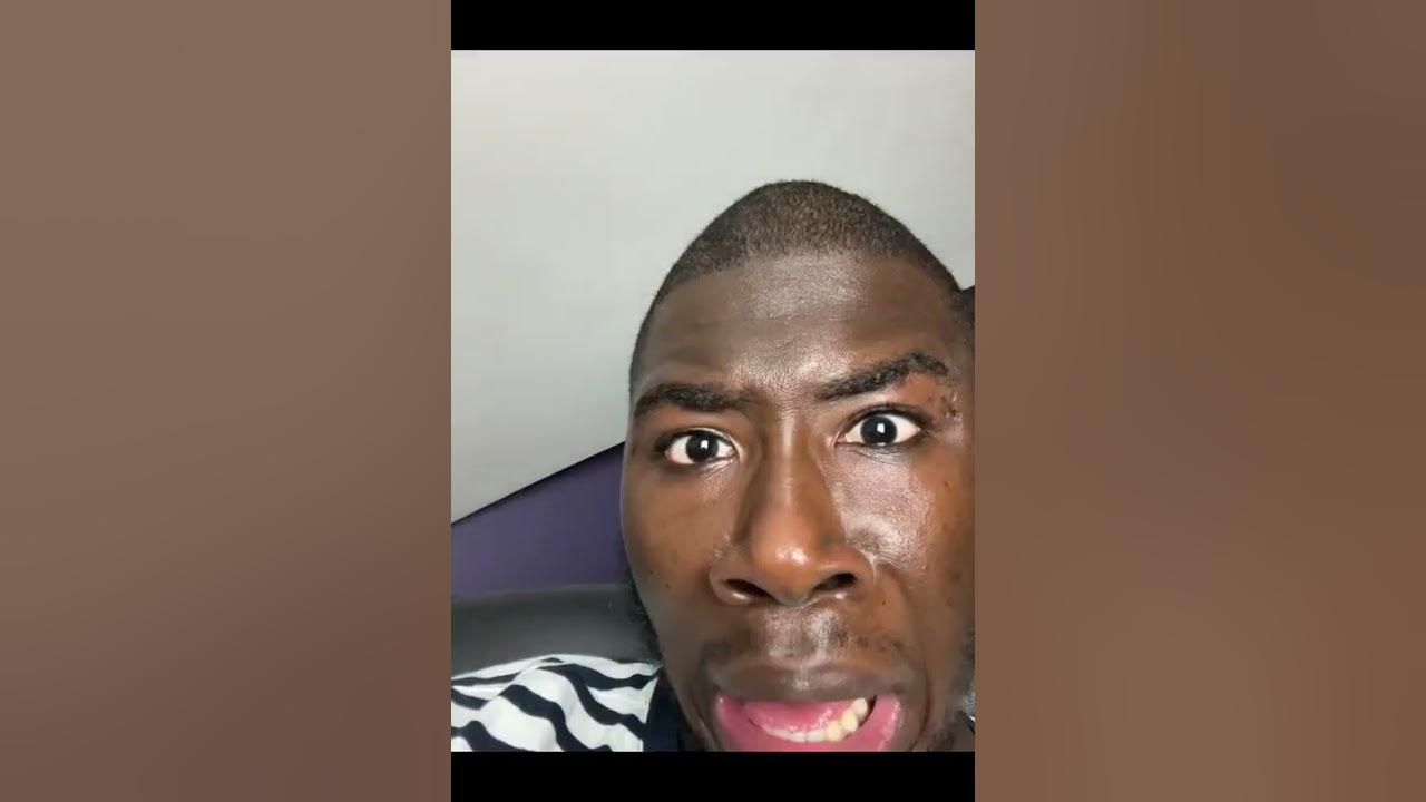 guy with dent in head (meme) - YouTube