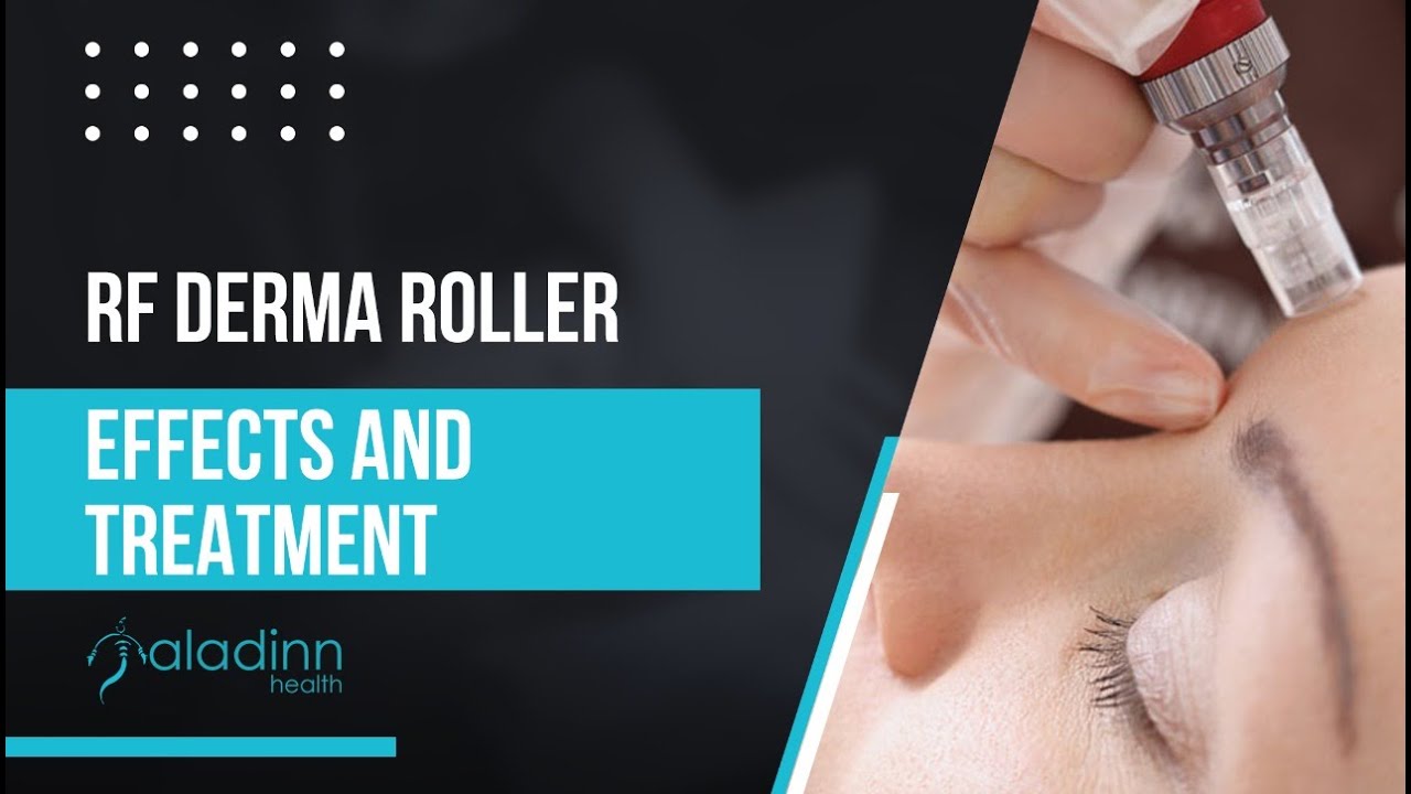 RF Derma Roller - Effects and Treatment - YouTube