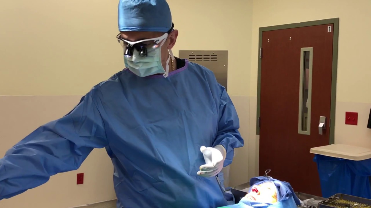 Rhinoplasty Surgery Video Technique Demonstration: Tip, Hump and ...