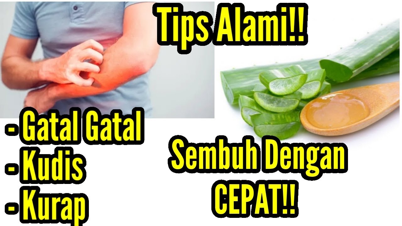 Cara Alami Mengatasi Gatal-Gatal Dalam Hitungan Menit l OBAT GAL PALING ...