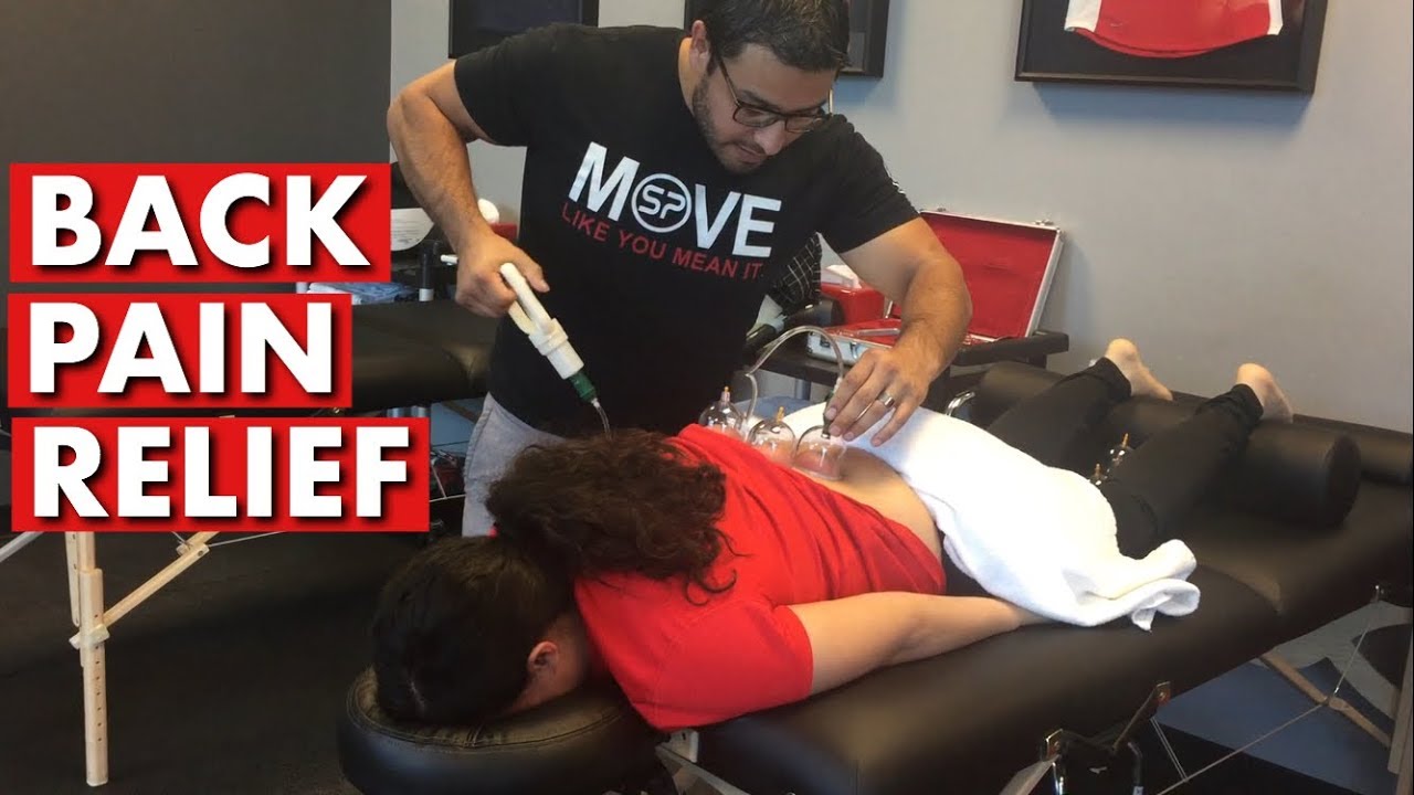 Back Pain Relief With Cupping Therapy At Sports Performance Physical ...