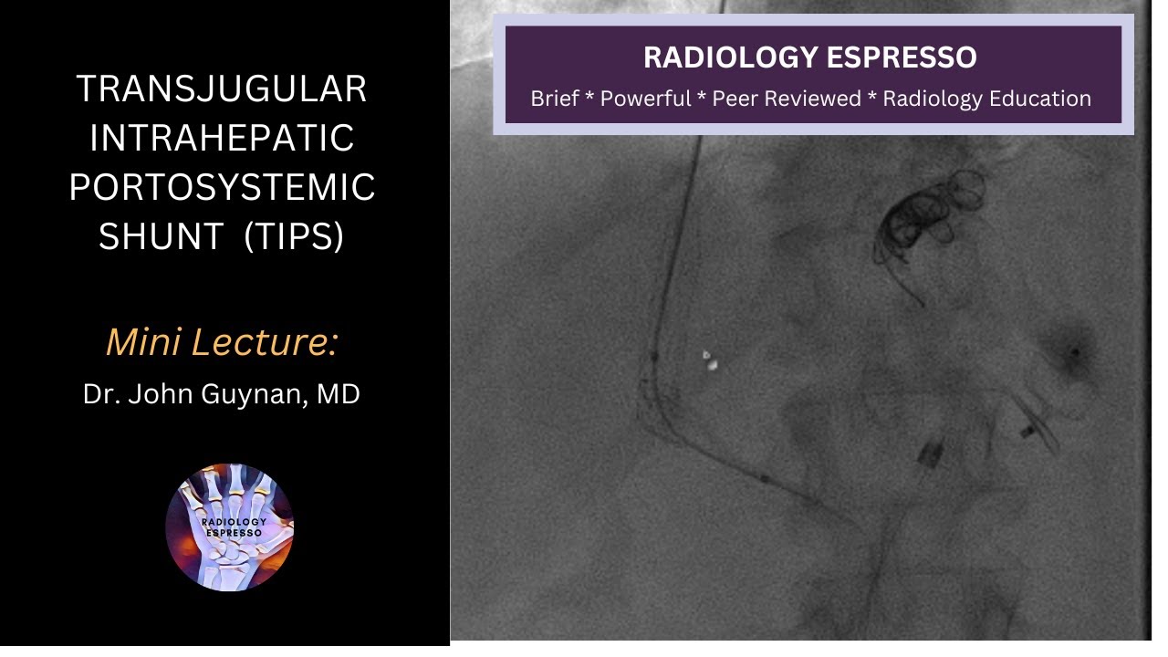 TRANSJUGULAR INTRAHEPATIC PORTOSYSTEMIC SHUNT (TIPS): Mini Lecture, Dr ...