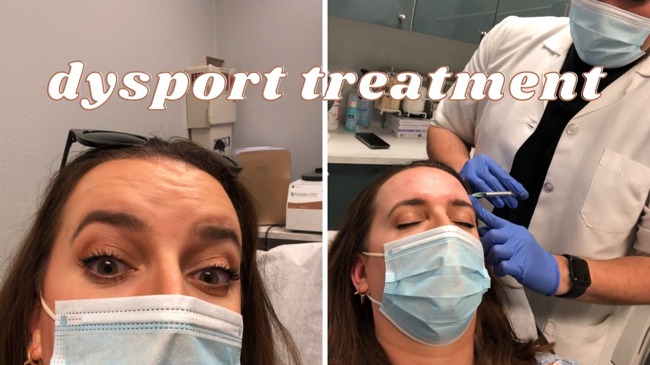 Full Dysport Treatment 💉 Crow's Feet, Forehead, 11s, Before & After ...