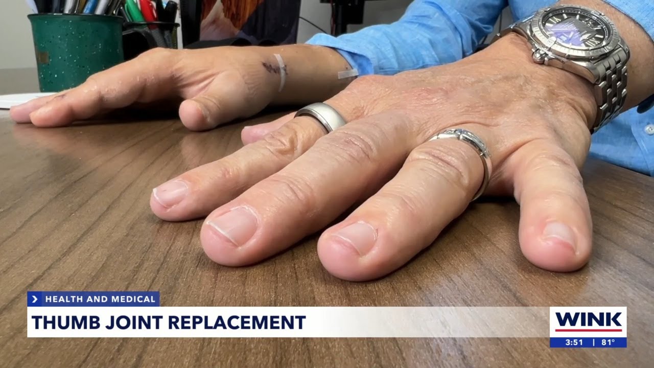 Innovative thumb joint replacement surgery - YouTube