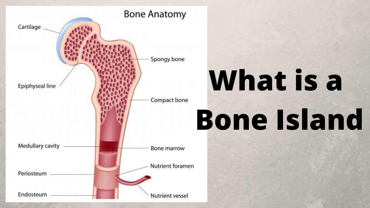 What Is A Bone Island YouTube what-is-a-bone-island-youtube
