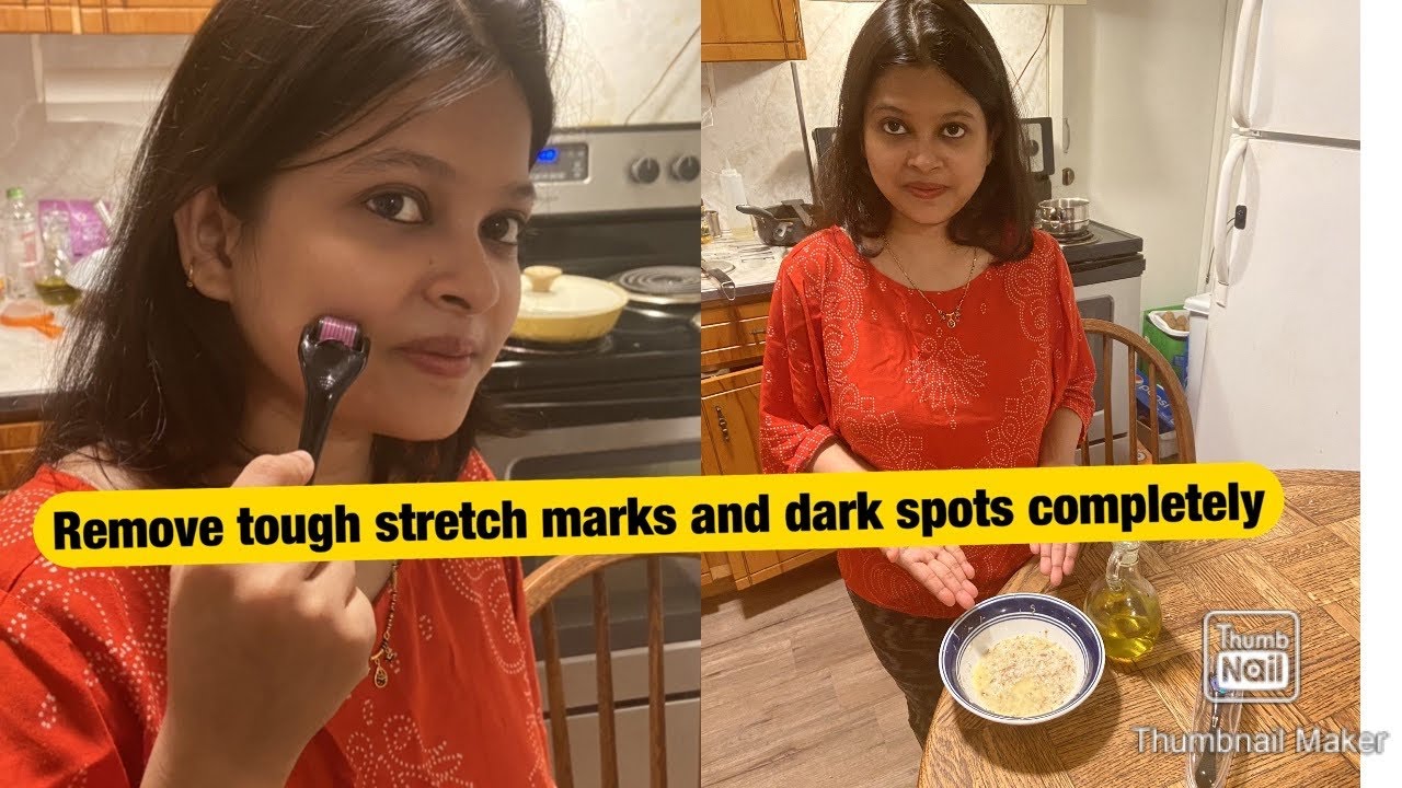 No stretch marks | No tough spots on skin | NO WRINKLES | glowing skin ...
