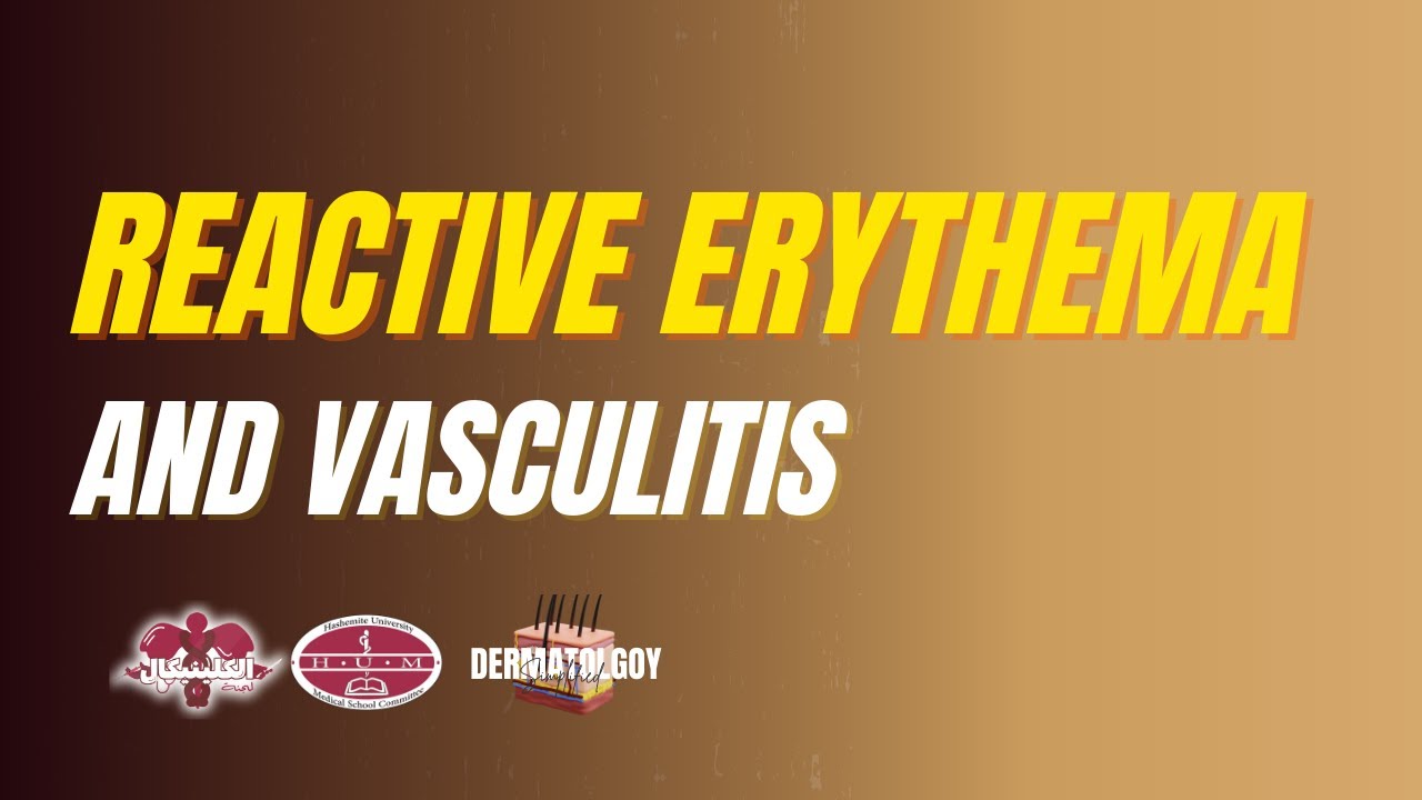 Dermatology L5 : Reactive erythema and vasculitis - YouTube