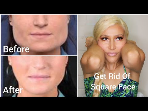 How To Get Rid Of Square Face Shape Naturally | Reshape & Slim Square Jaw Into Oval Face Exercise