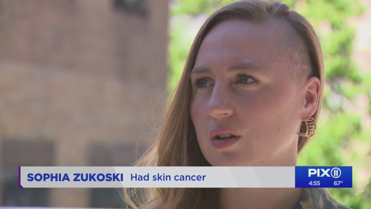 Woman who had skin cancer as young adult shares her story - YouTube