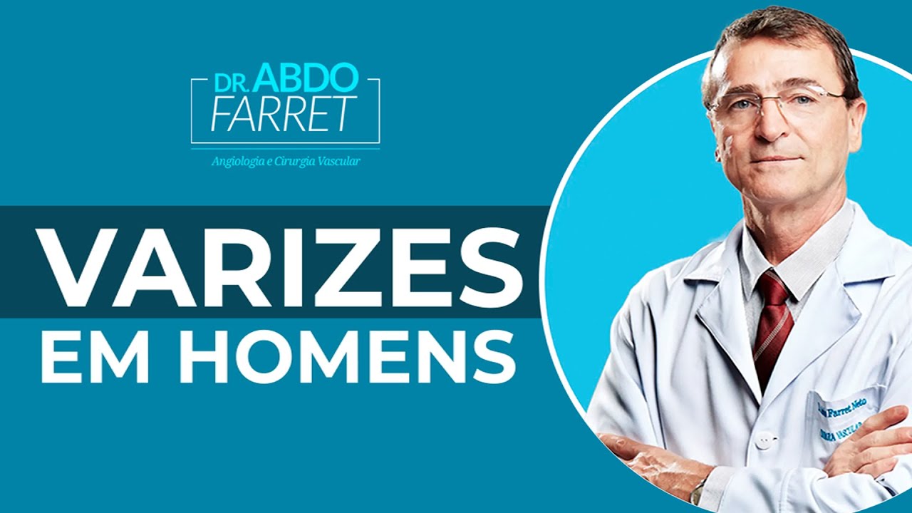 VARIZES EM HOMENS - SAIBA OS RISCOS E COMO TRATAR - YouTube