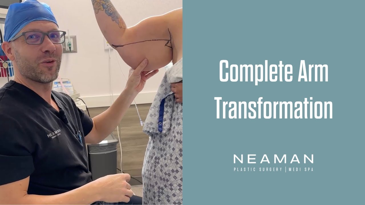 Complete Arm Transformation - YouTube