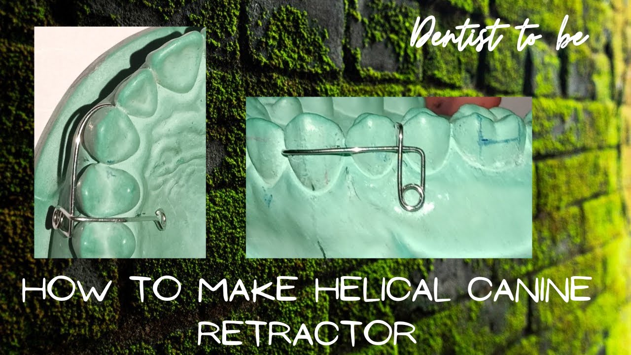 How to fabricate Helical canine retractor - YouTube