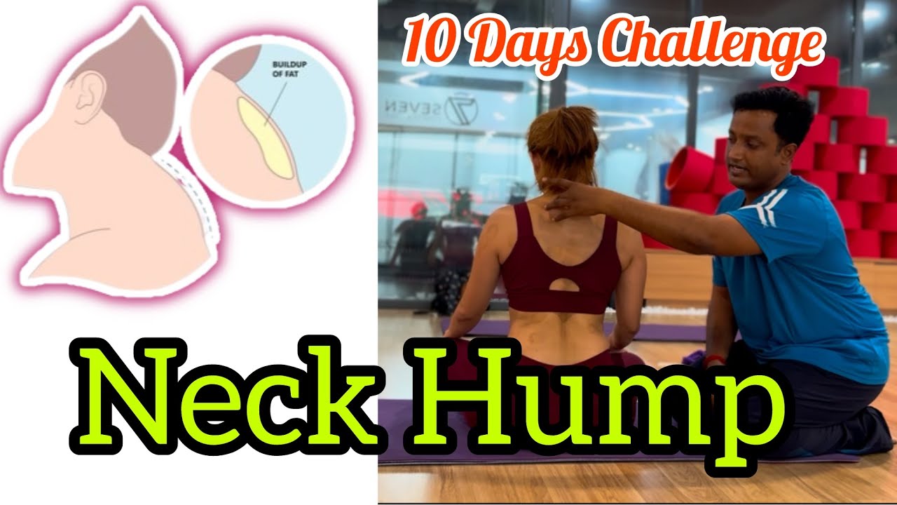 5 Best Exercise For Neck Hump #neckhump How to reduce Neck Hump 2025 ...