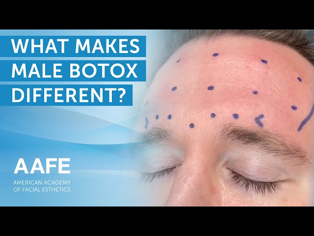Botox Men Forehead