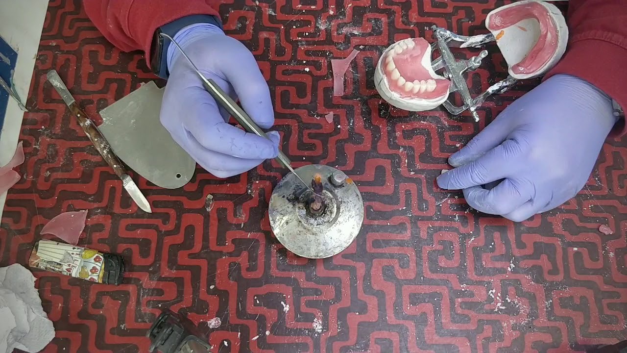 Macheta bazelor protezelor si alegerea si montarea dintilor - YouTube