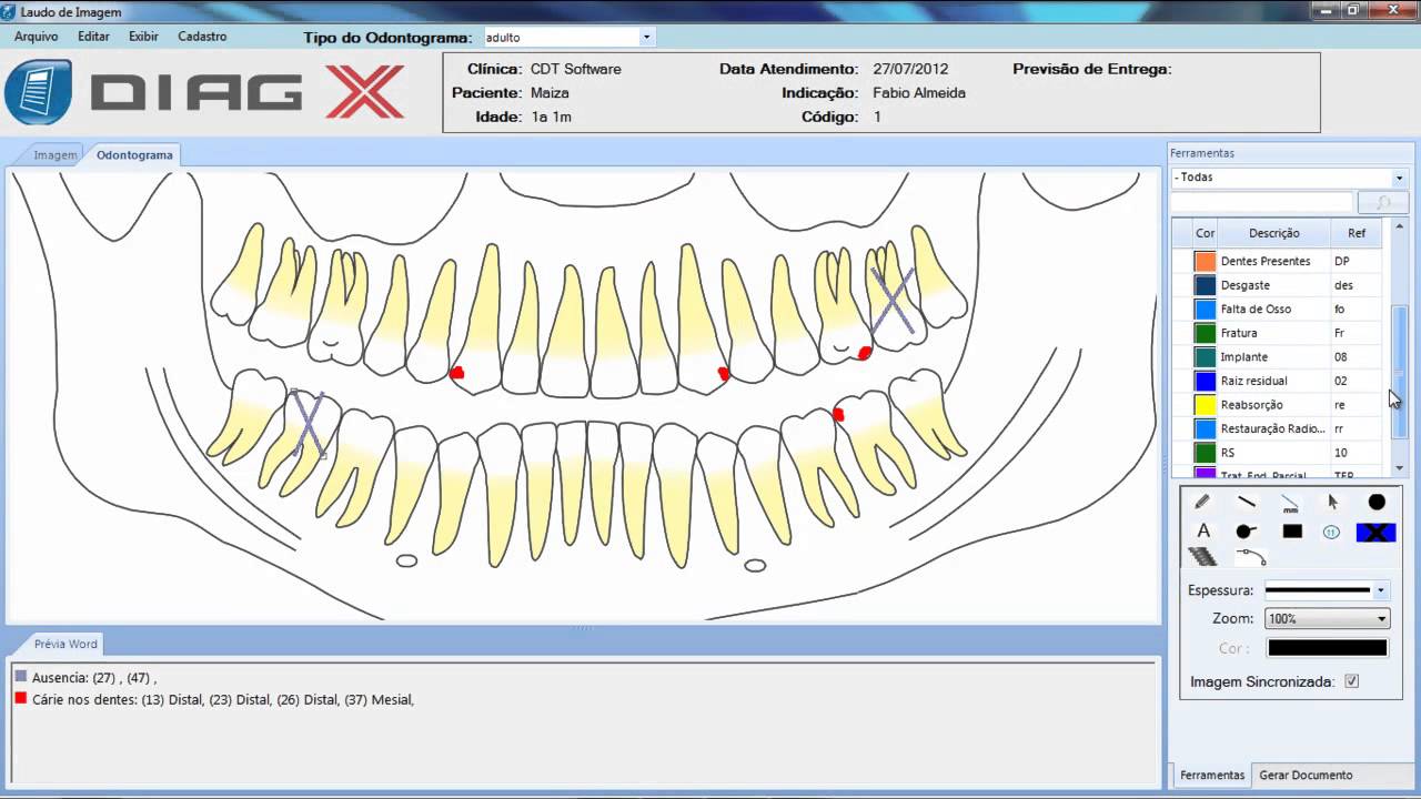 DiagX - Laudos automatizados - YouTube