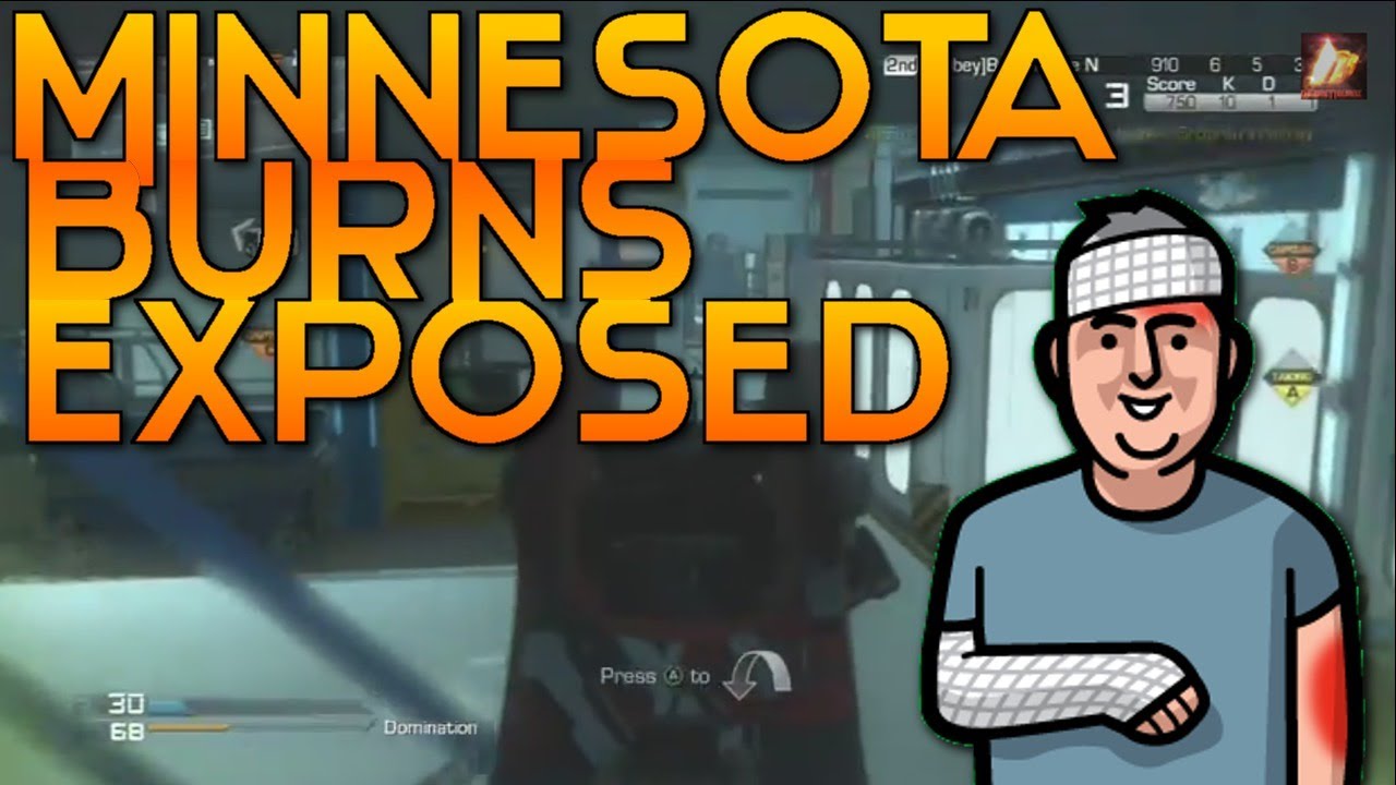 MinnesotaBurns Threatens a Child? "MinnesotaBurns Exposed" Threatens to ...