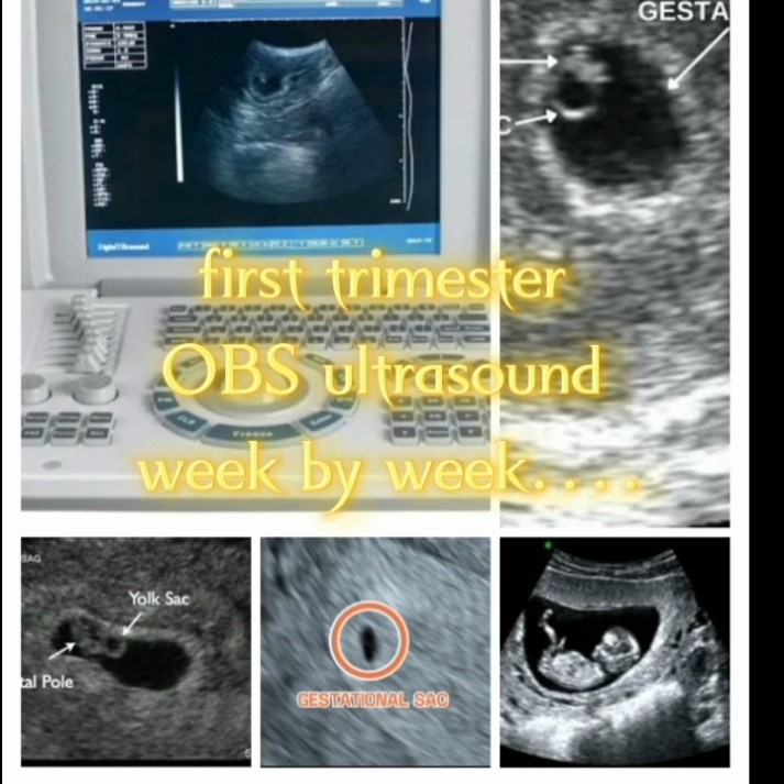 # OBS ultrasound #first trimester ultrasound week by week # week by ...