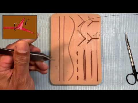 Dr. Azad's Surgery Basics: Three Point Suture - YouTube