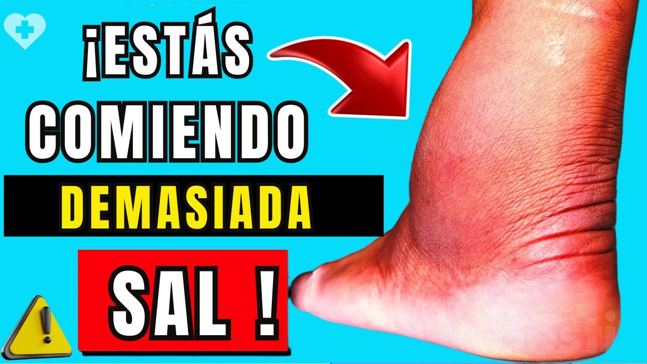 Estás Comiendo DEMASIADA Sal Sin Siquiera Saberlo: ¡Aquí Tienes 7 ...