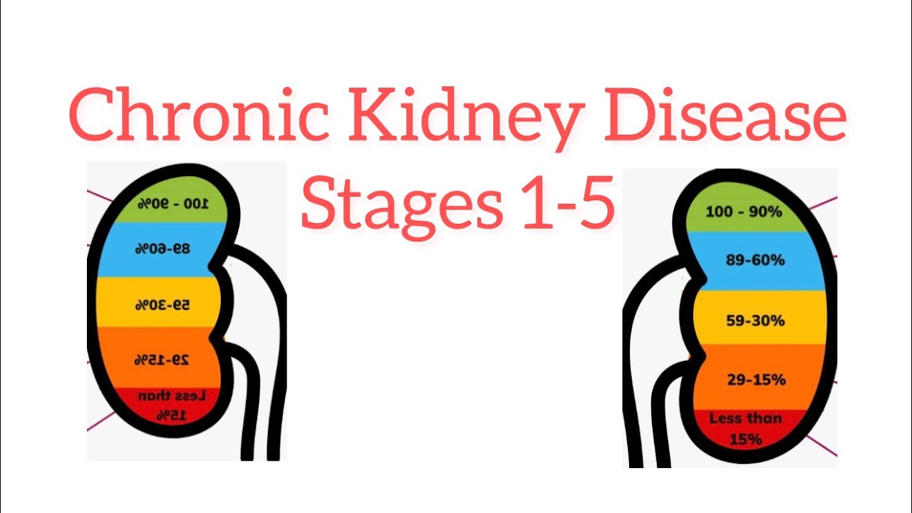 A detailed explanation of Chronic Kidney Disease or CKD - YouTube