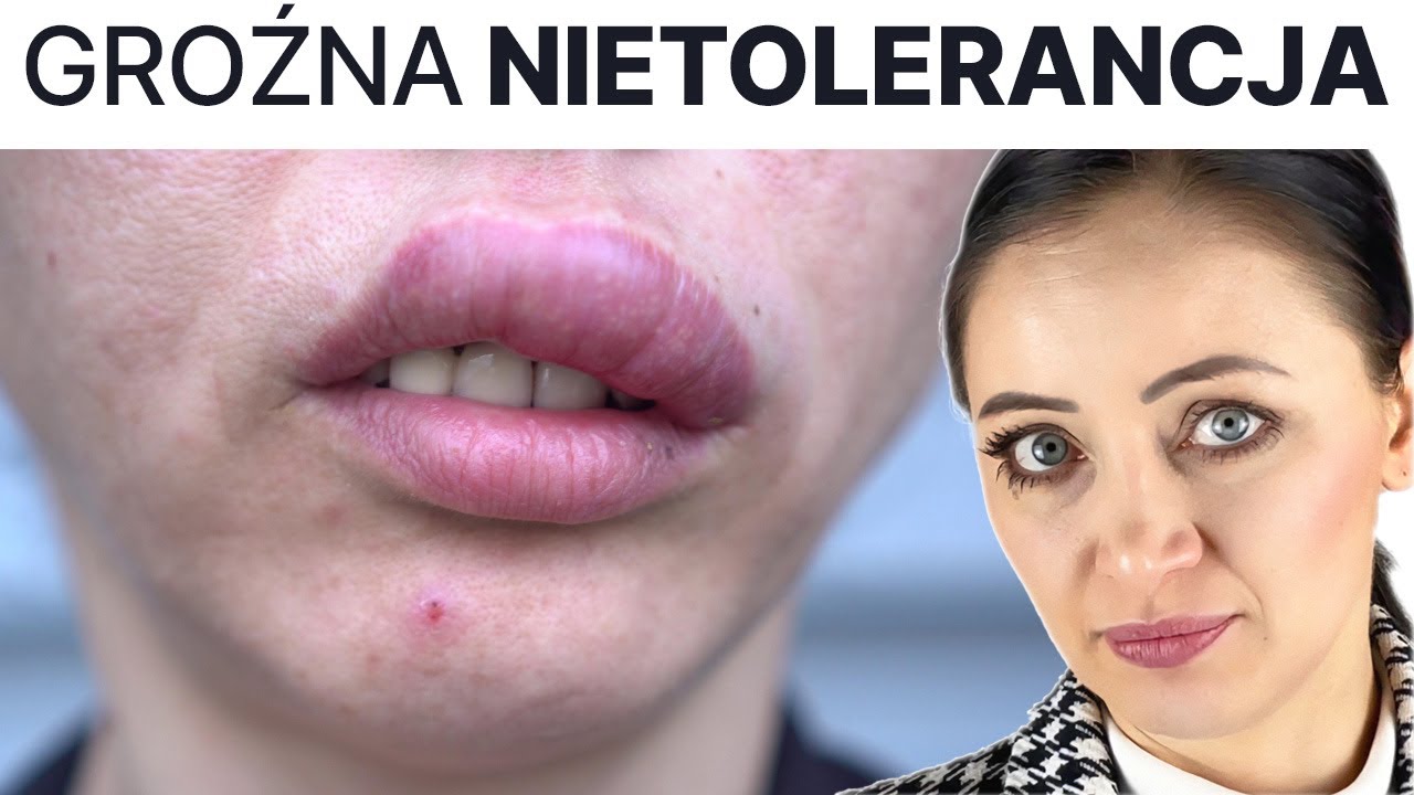 Nietolerancja, która zagraża zdrowiu, a nawet życiu - YouTube