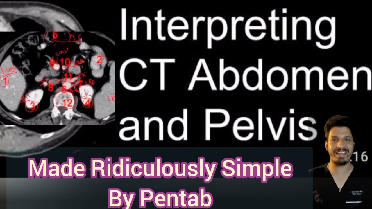 ct scan interpretation|ct scan abdomen andpelvis|ct scan of pelvis|ct ...