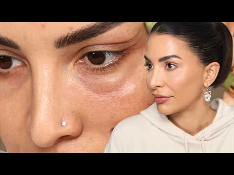 No More Under Eye Bags! How to Cover Them Up Instantly