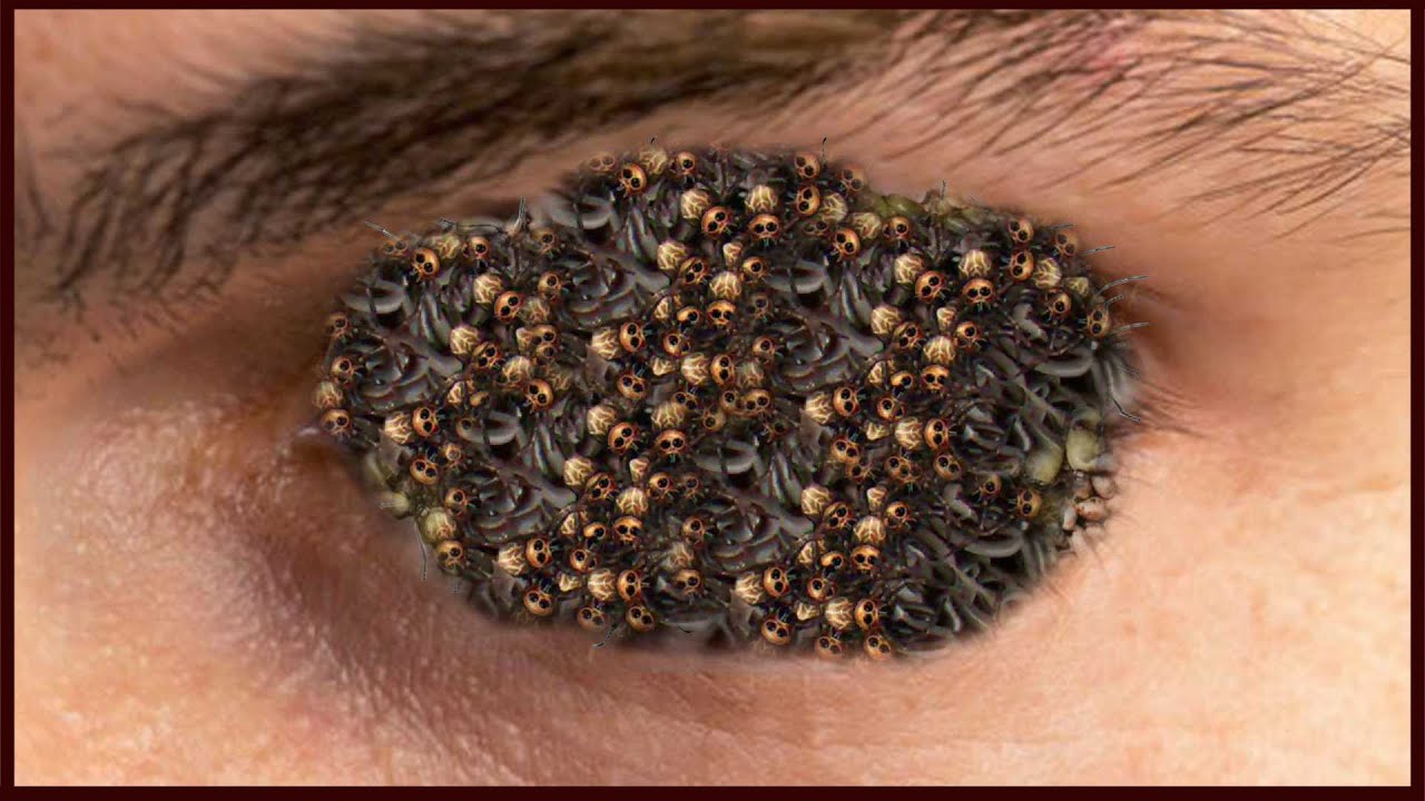 Eye Worms Treatment ASMR 2D Animation Dog ticks and maggots infection ...