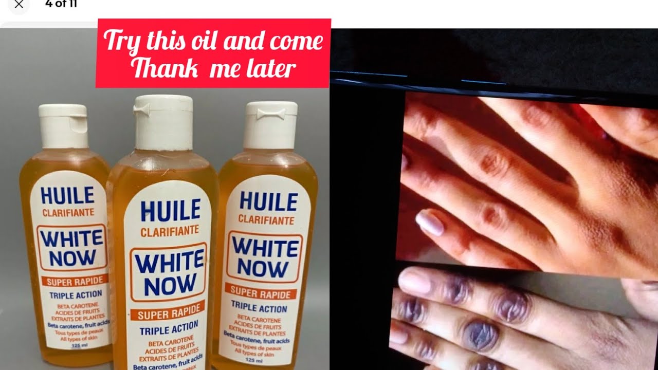 WHITE NOW SUPER RAPIDE TRIPLE ACTION WHITENING OIL WITH FANTASTIC ...