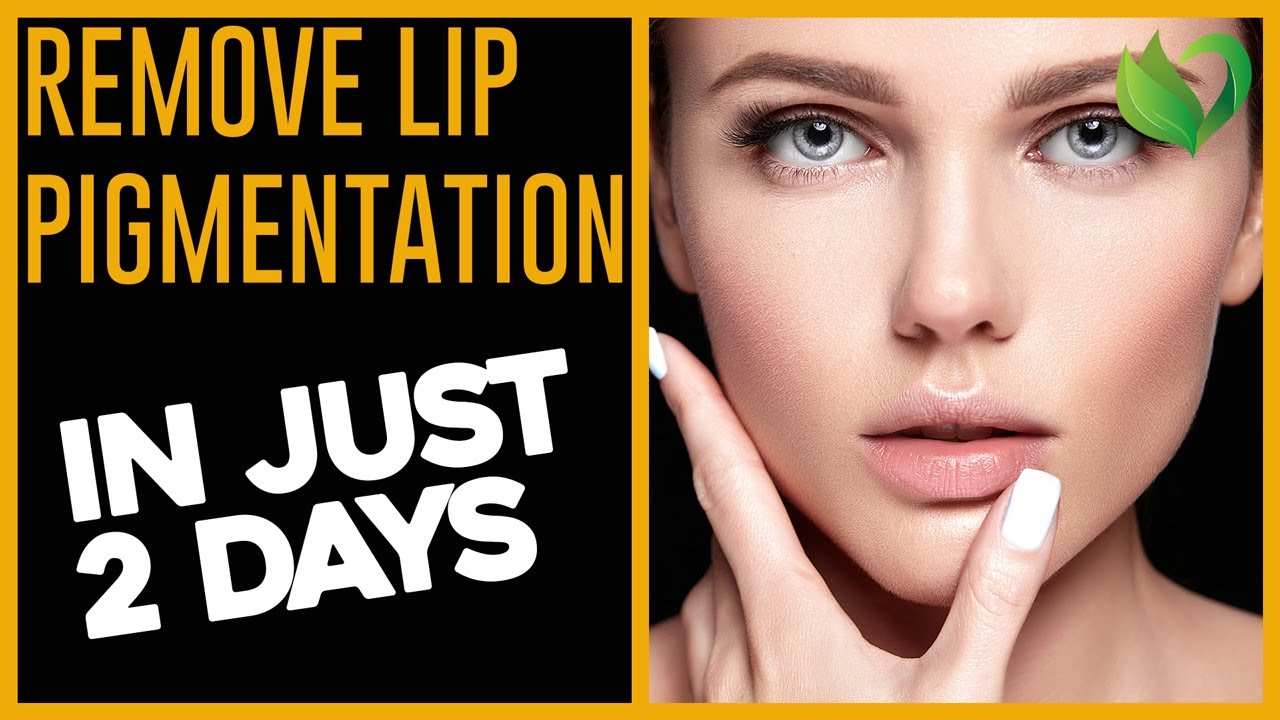Lip Pigmentation Home Remedies | Remove Lip Blackness | In 2 Days - YouTube