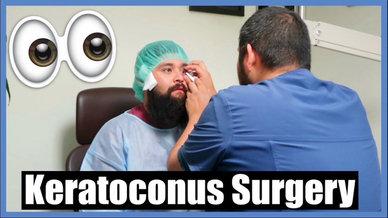 Hiram's Eye Surgery Day! Intacs & Holcomb C3-R Crosslink | April 26 ...
