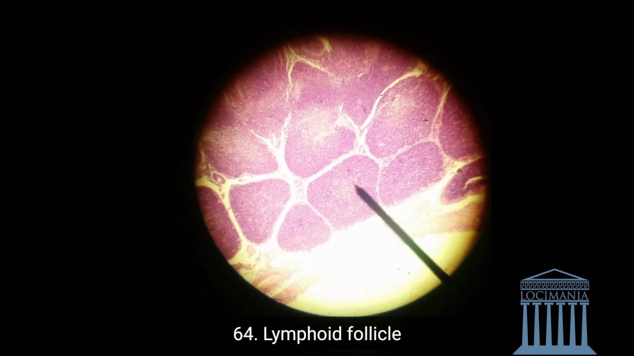 Histology - Vermiform Appendix - YouTube