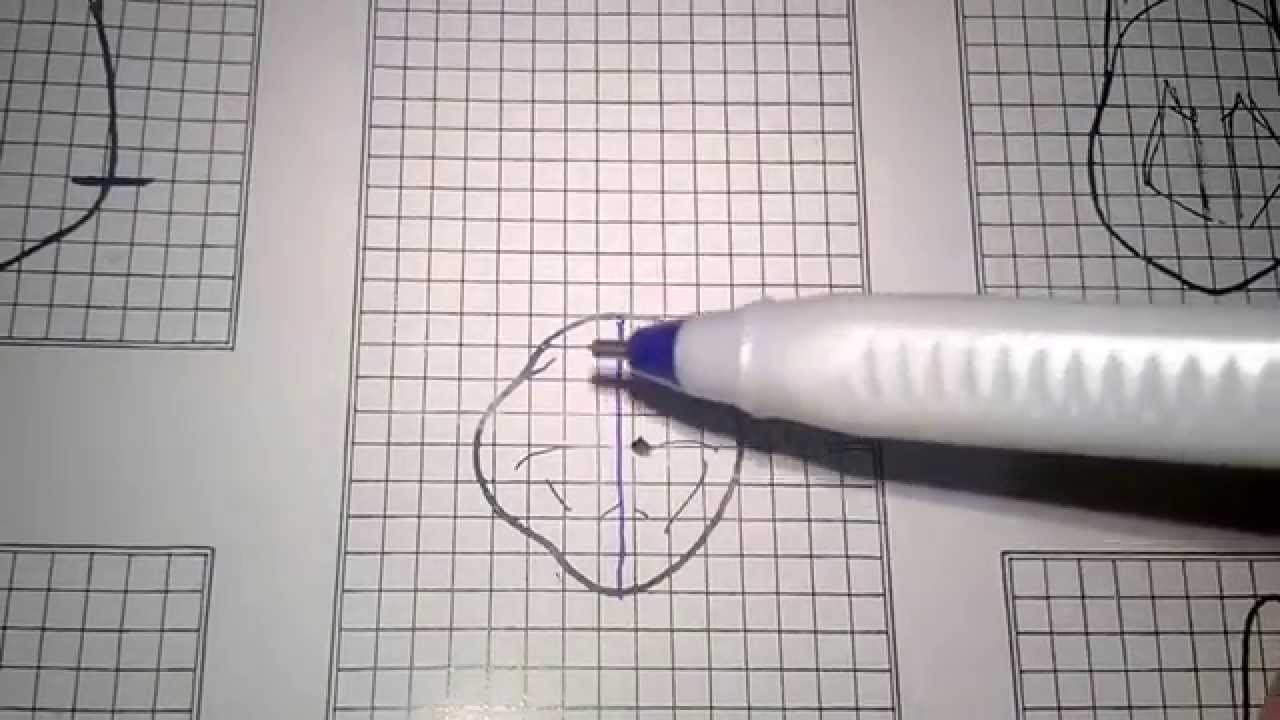incisal aspect maxillary right canine - YouTube