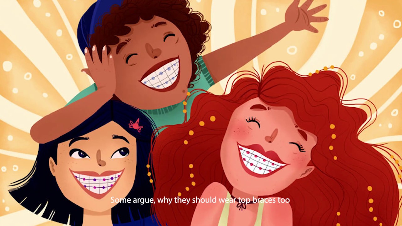 Single Arch Braces - Upper Teeth Braces or Lower Teeth Braces ONLY ...