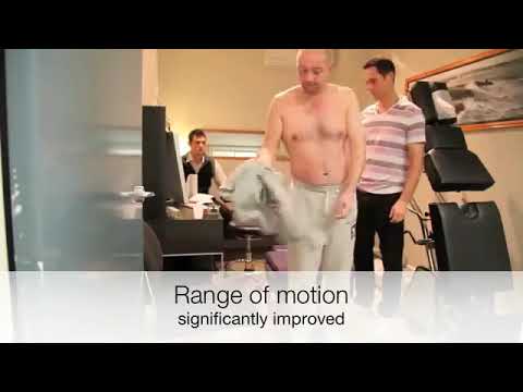 Dr. Ian – Bandscheibenvorfall im Notfall behoben durch Gonstead Chiropractic