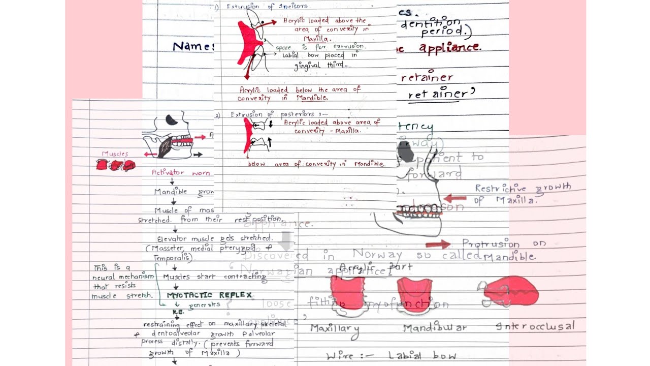 Activator|| Myofunctional Appliance|| NOTES - YouTube